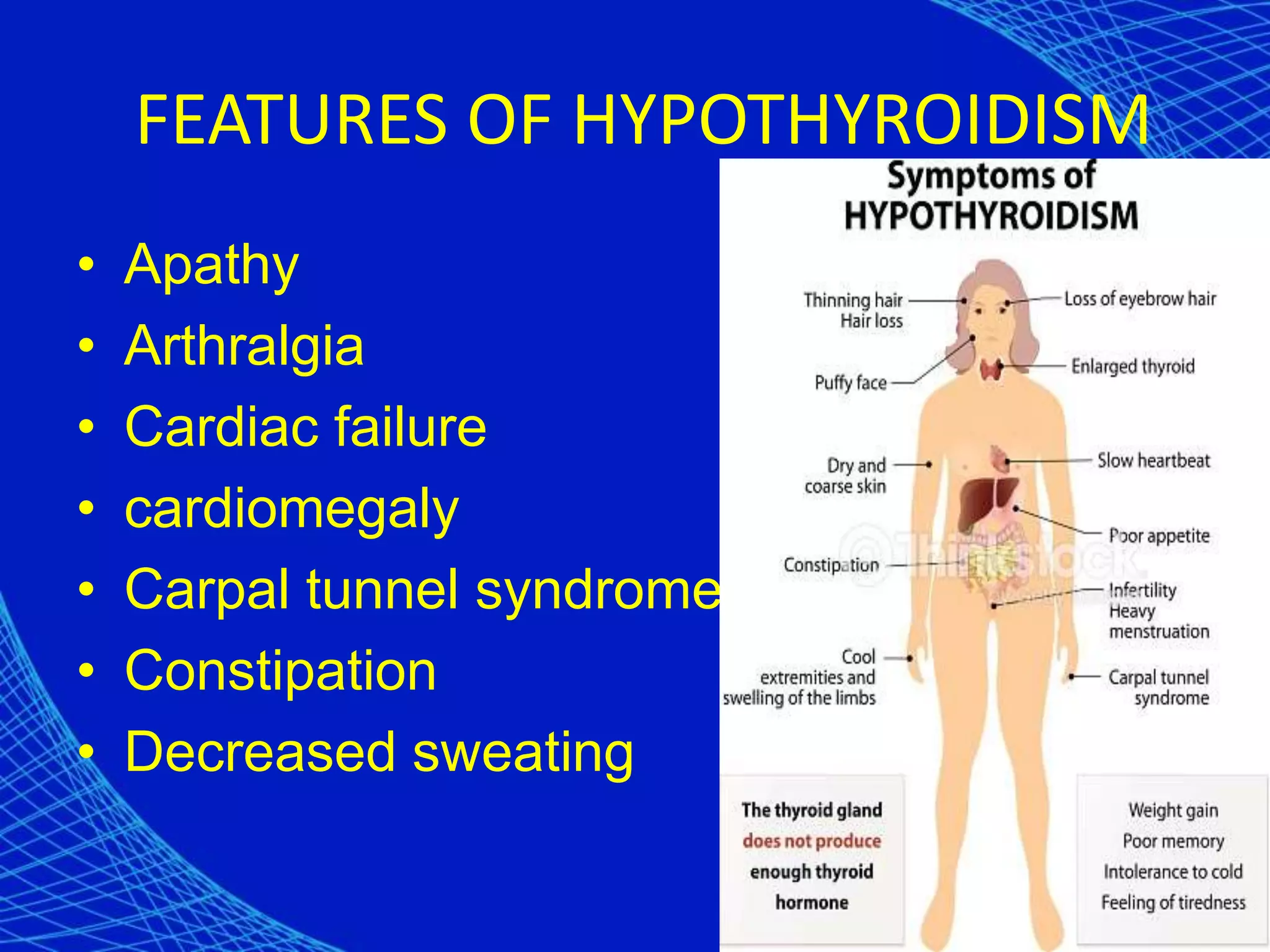 Anaesthesia for hypothyroid patient | PPTX