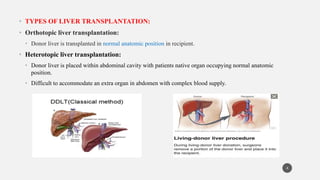 Anaesthesia for liver transplantation.pptx