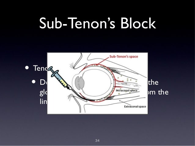 Anaesthesia for ophthalmic surgery