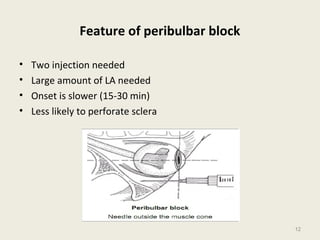 Anaesthesia for Ophthalmology surgery | PPT