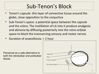 Anaesthesia for Ophthalmology surgery | PPT