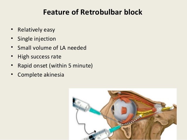 Anaesthesia for Ophthalmology surgery