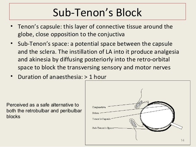 Anaesthesia for Ophthalmology surgery
