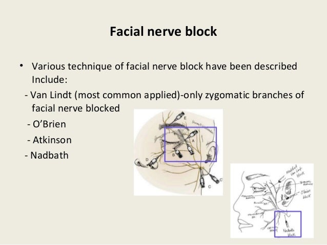 Anaesthesia for Ophthalmology surgery