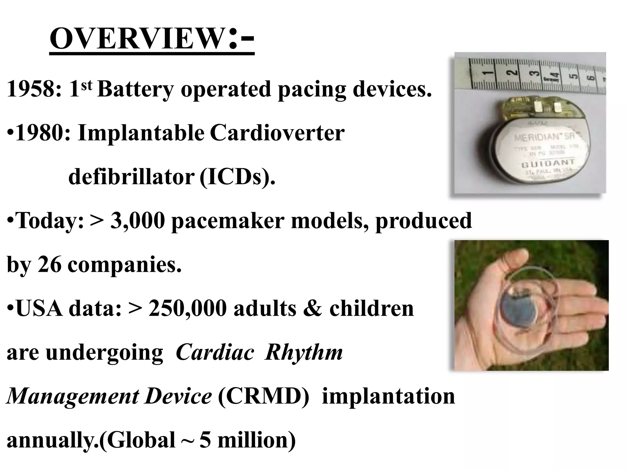Anaesthesia for patient with pacemaker | PPTX