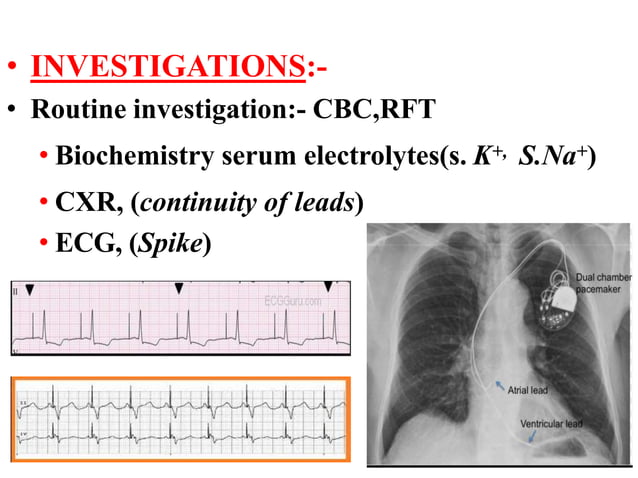 Anaesthesia for patient with pacemaker