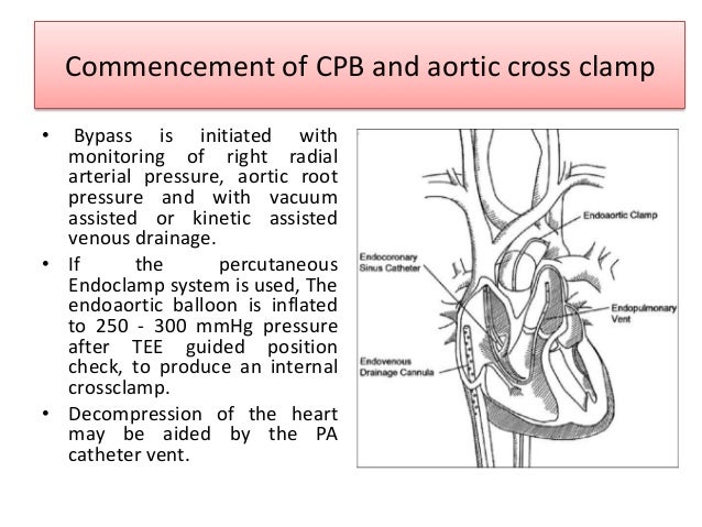 Anaesthesia for robotic cardiac surgery