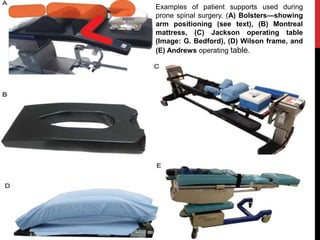 Anaesthesia for spine surgeries | PPTX