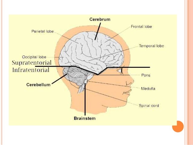 Anaesthesia for supratentorail mass