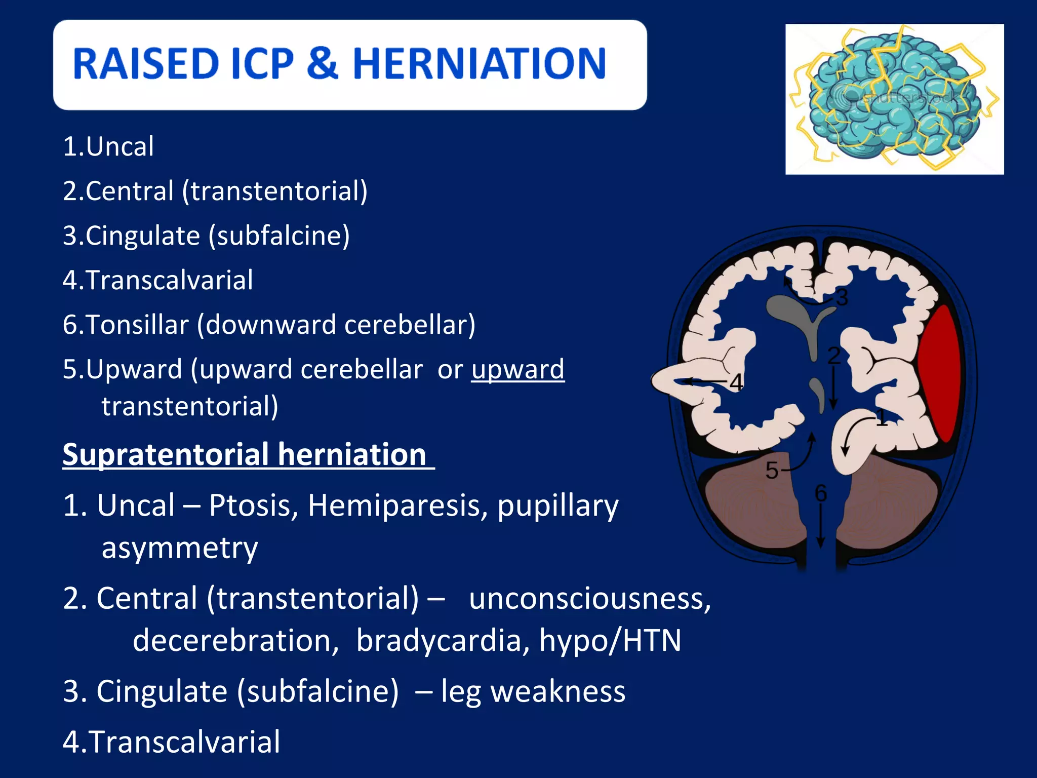 Anaesthesia for supratentorial tumor surgeries | PPT