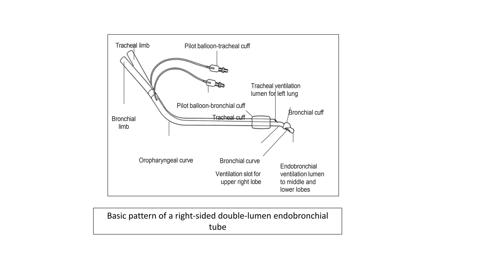 Anaesthesia for thoracic surgery and consideration.pptx