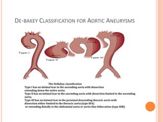 Anaesthesia for thoraco abdominal aortic surgery | PPTX