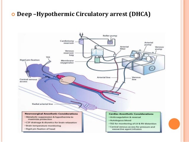 Anaesthesia for thoraco abdominal aortic surgery