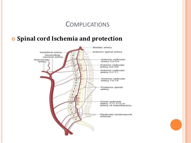 Anaesthesia for thoraco abdominal aortic surgery