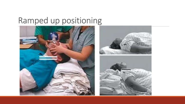 Anaesthesia in an obese patient | PPTX