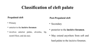 Anaesthesia in cleft and cleft palate surgeries ppt (1) (1).pptx