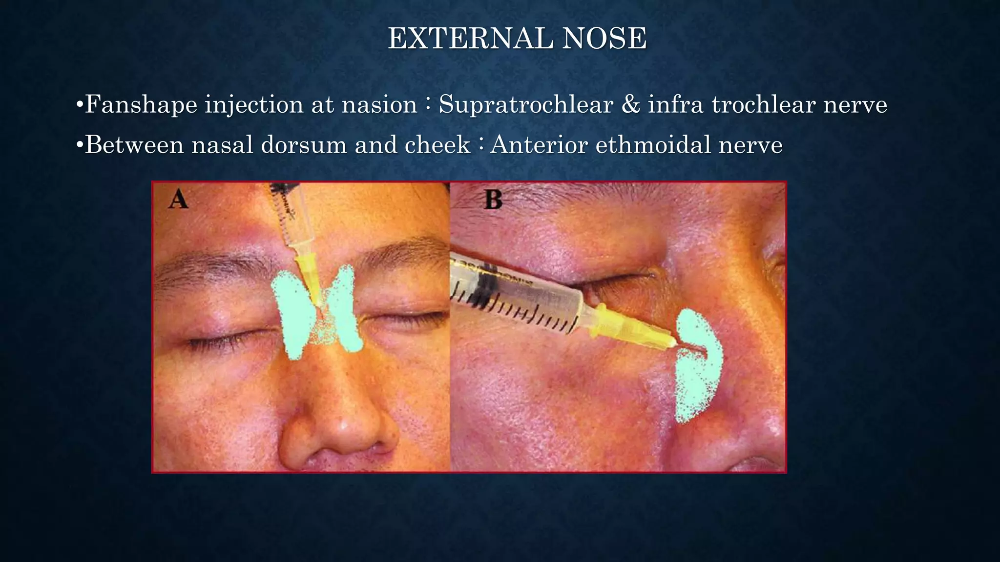 Anaesthesia in ent practice | PPTX
