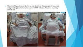 Anaesthesia in obesity | PPTX