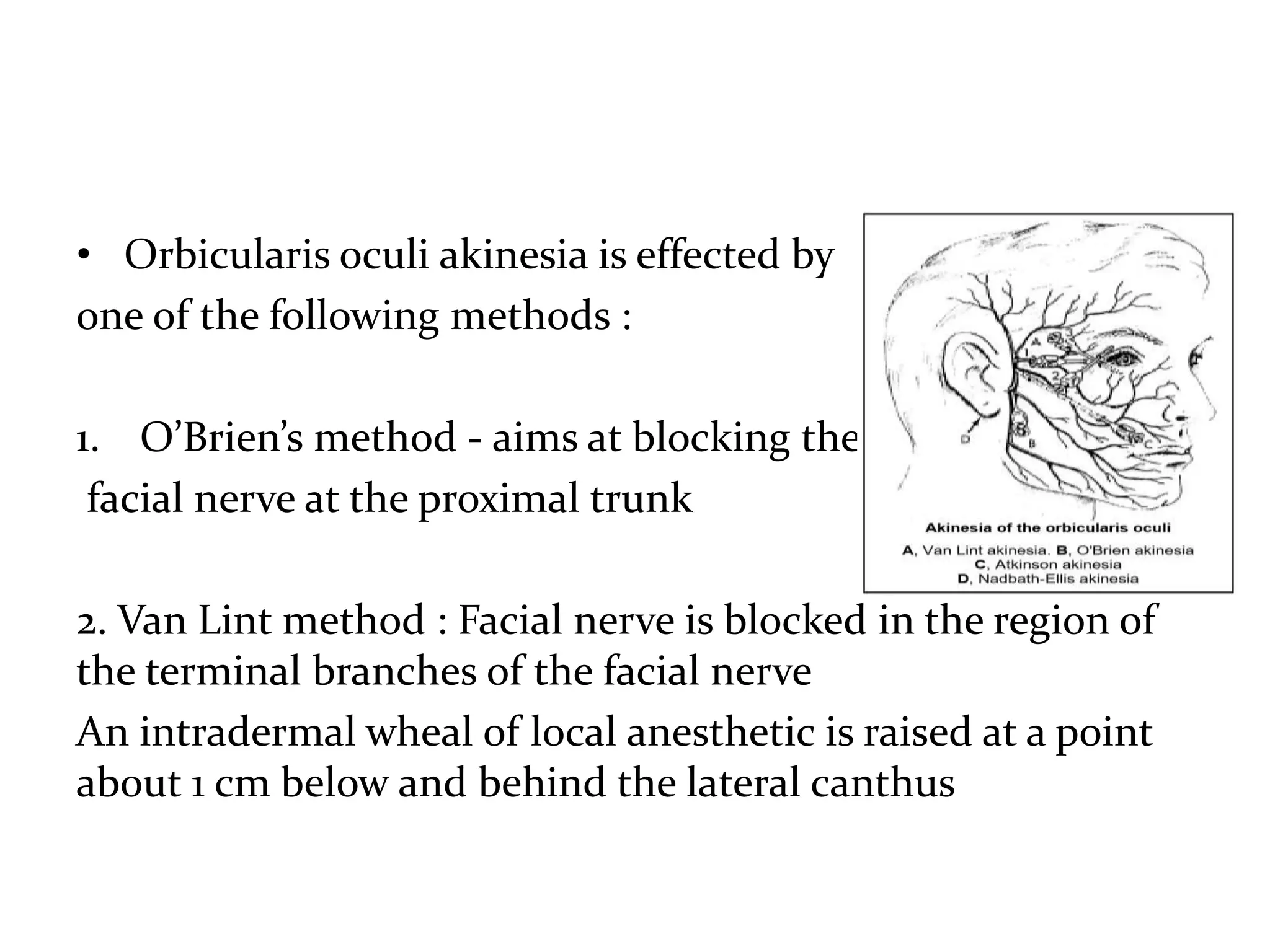 Anaesthesia in ophthalmic surgery | PPT