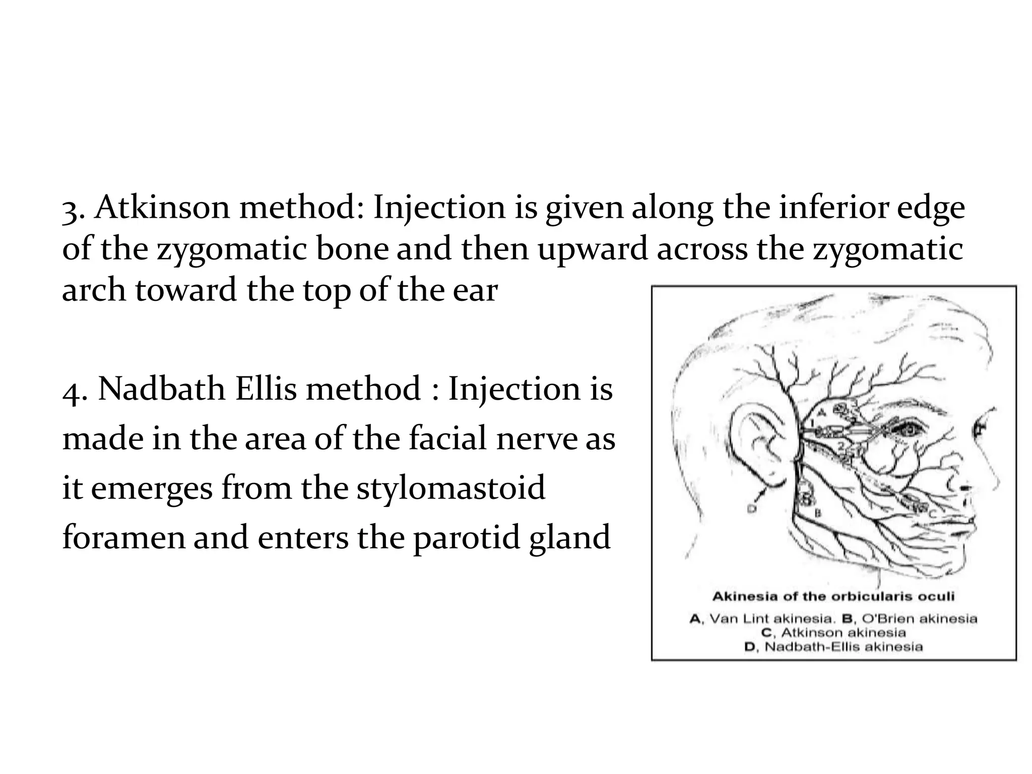 Anaesthesia in ophthalmic surgery | PPT
