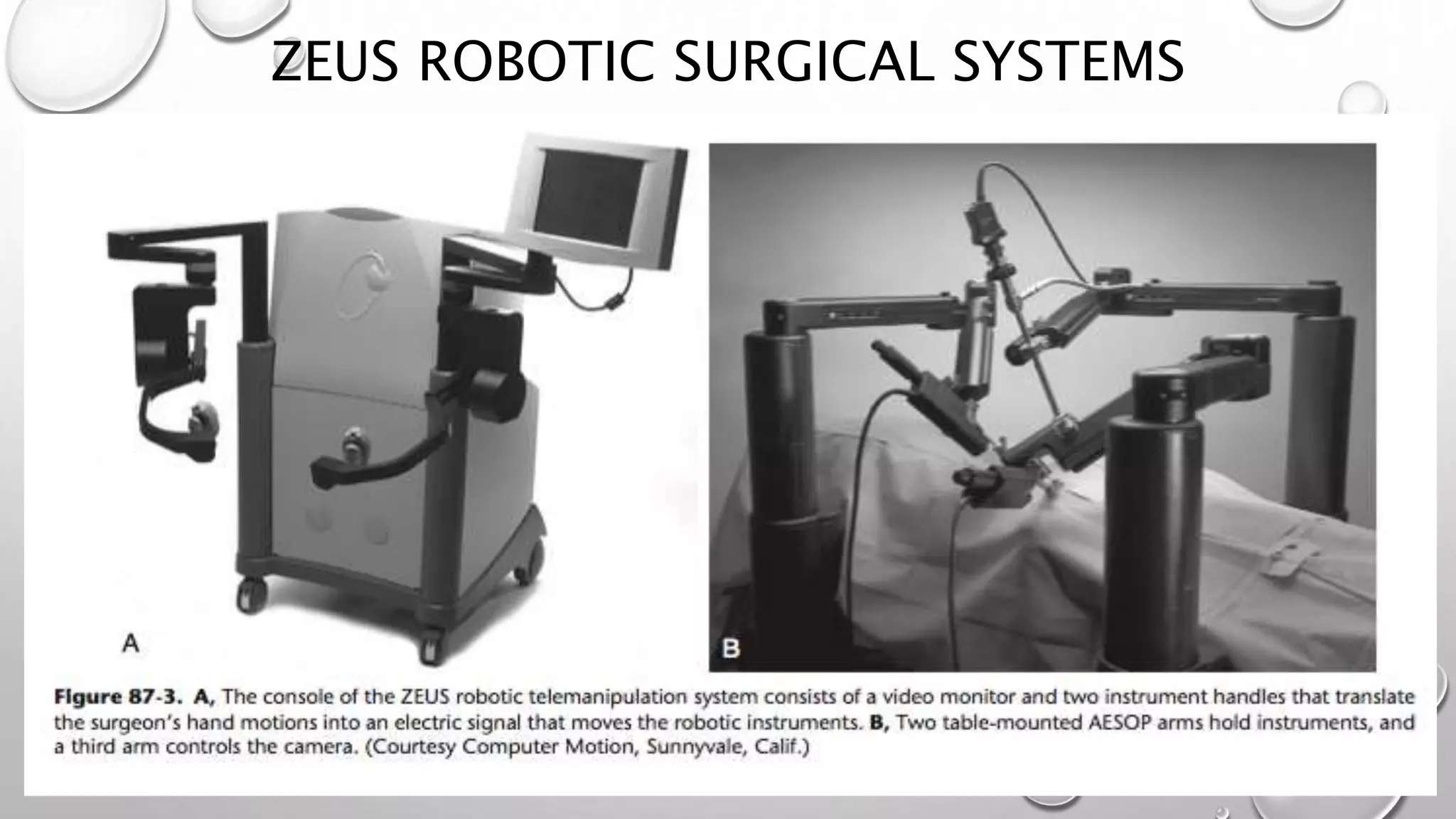 Anaesthesia in robotic surgery | PPTX