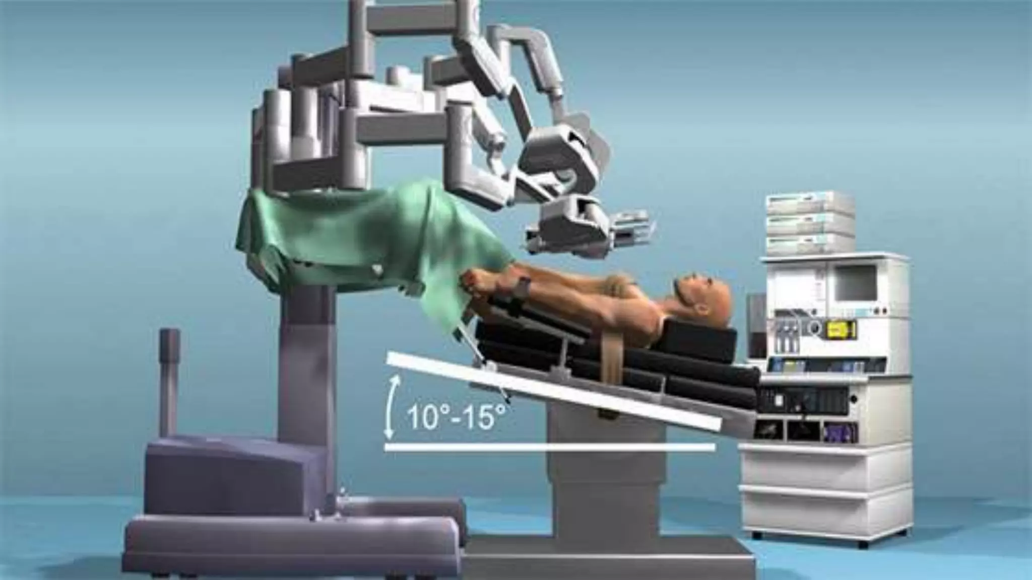 Anaesthesia in robotic surgery | PPTX