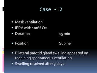 Anaesthesia mumps | PPTX