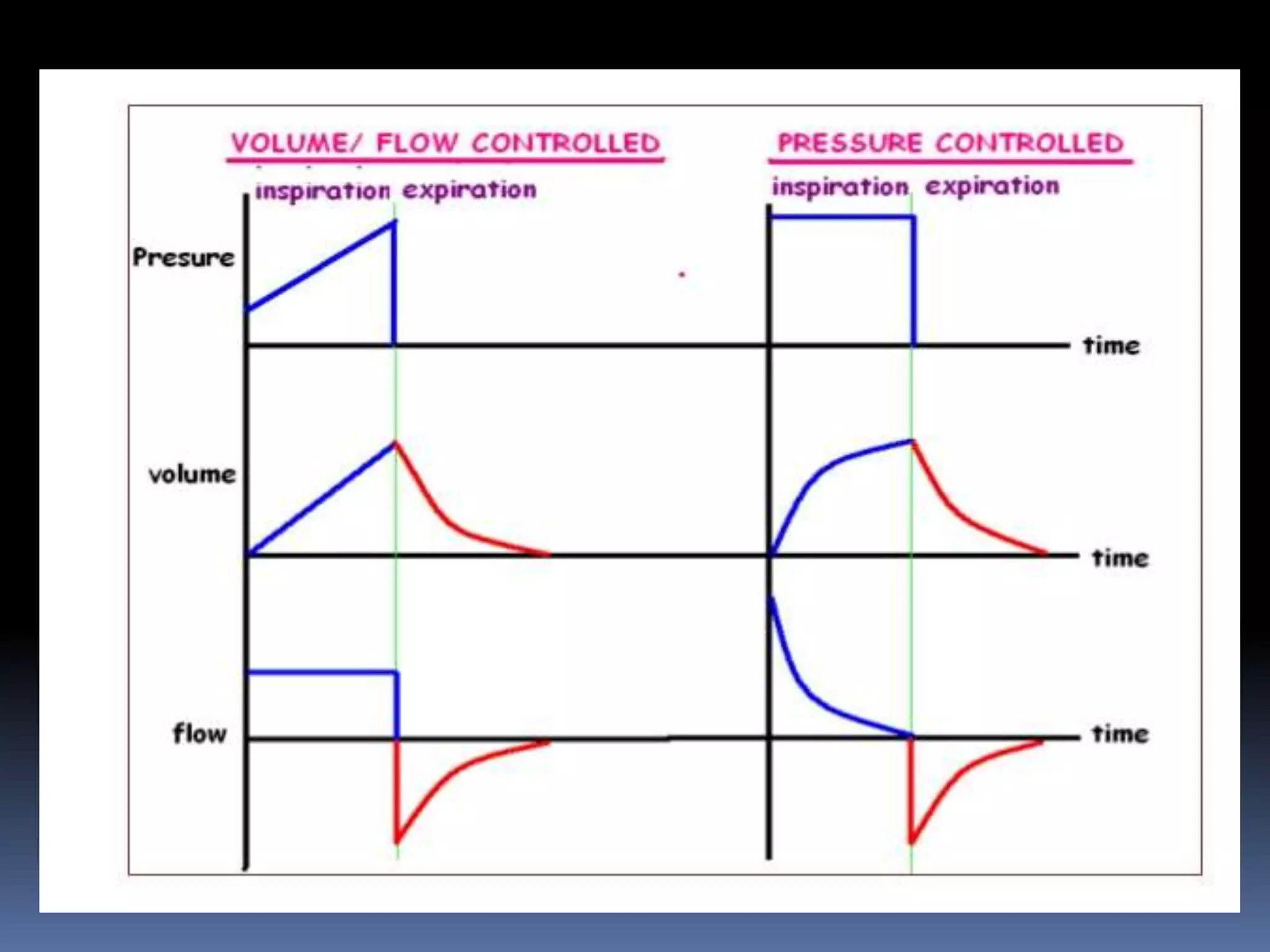 Anaesthesia ventilators | PPTX