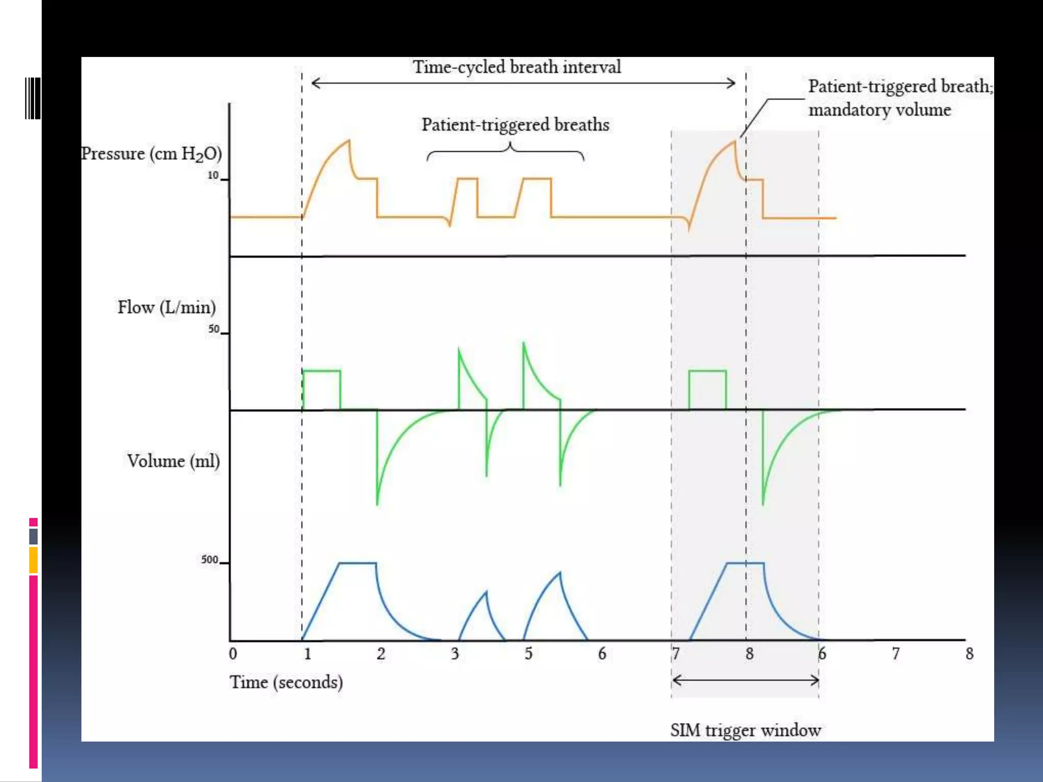 Anaesthesia ventilators | PPTX