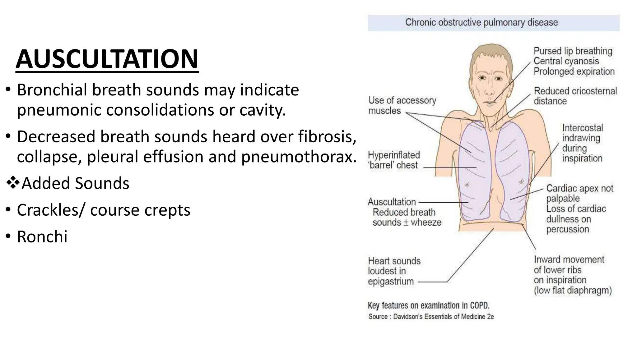 Anaesthesic Considerations in COPD.pptx
