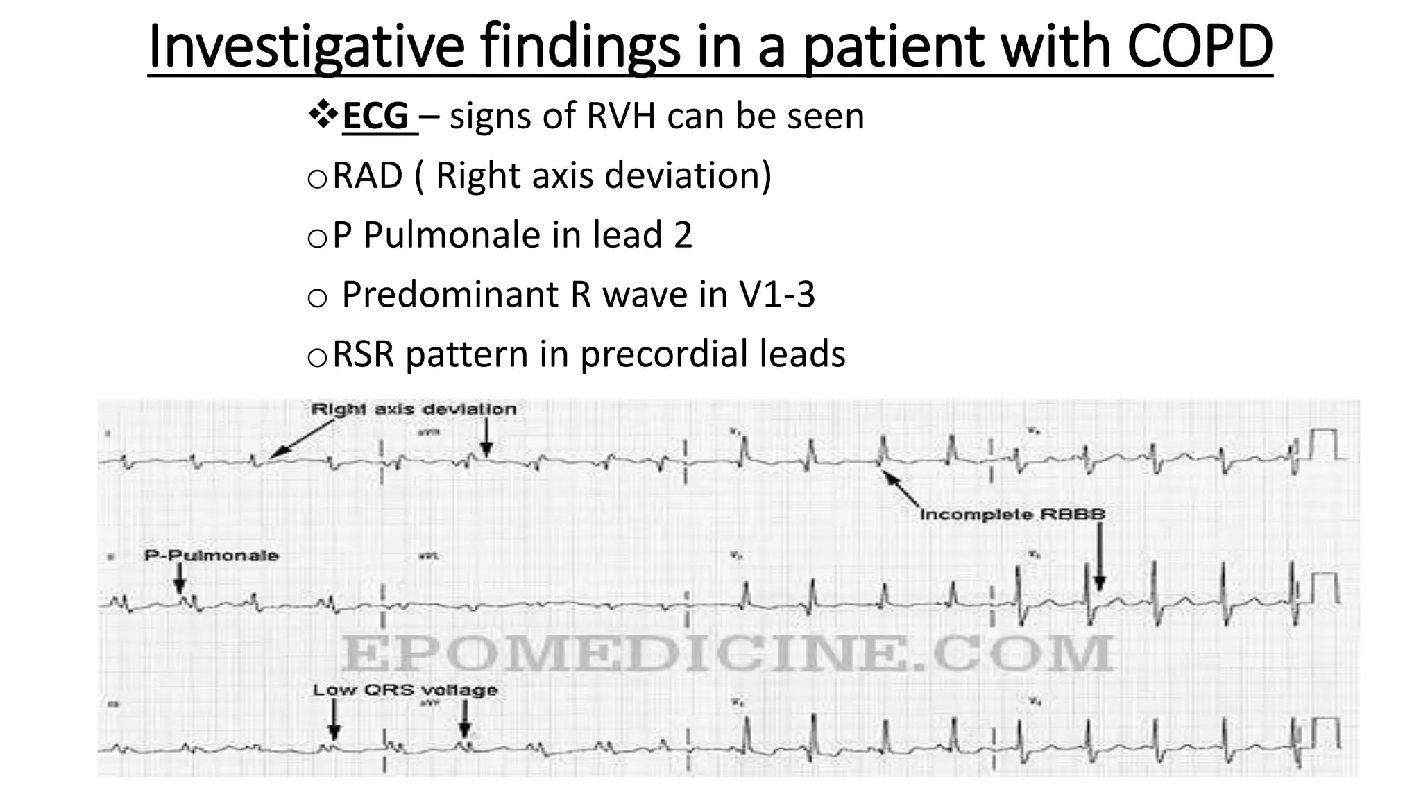Anaesthesic Considerations in COPD.pptx
