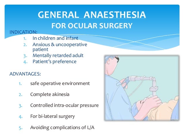 Anaesthessia for EYE Surgery Ramprasad