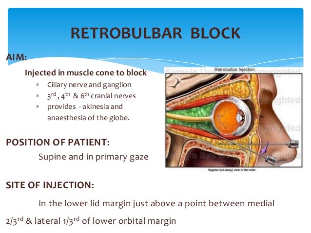 Anaesthessia for EYE Surgery Ramprasad