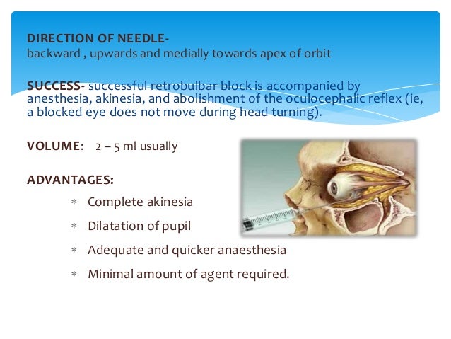 Anaesthessia for EYE Surgery Ramprasad