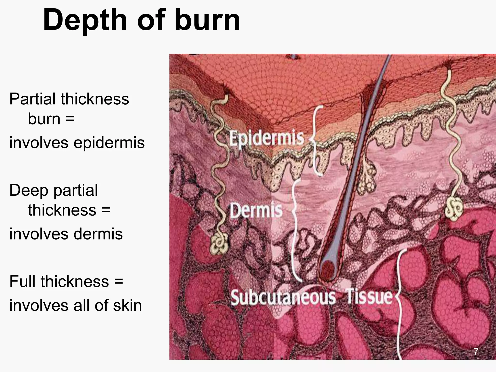 Anaesthetic-Management-of-Burns.pptx