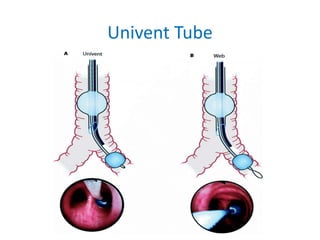 Anaesthetic consideration for one lung ventilation | PPTX