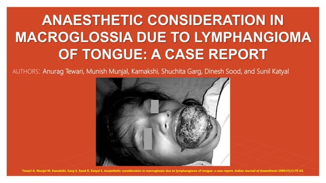 ANAESTHETIC CONSIDERATION IN MACROGLOSSIA DUE TO LYMPHANGIOMA OF TONGUE ...
