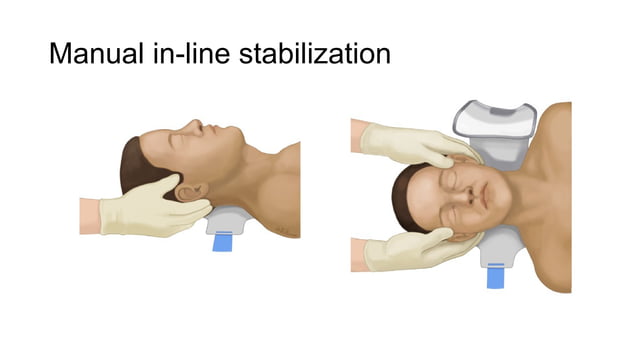 Anaesthetic consideration in spinal cord injury.pptx