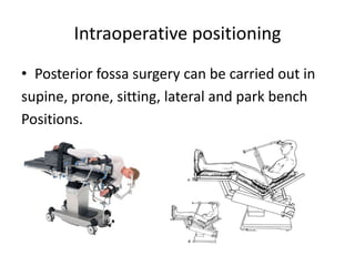 Anaesthetic considerations for posterior fossa surgery | PPTX