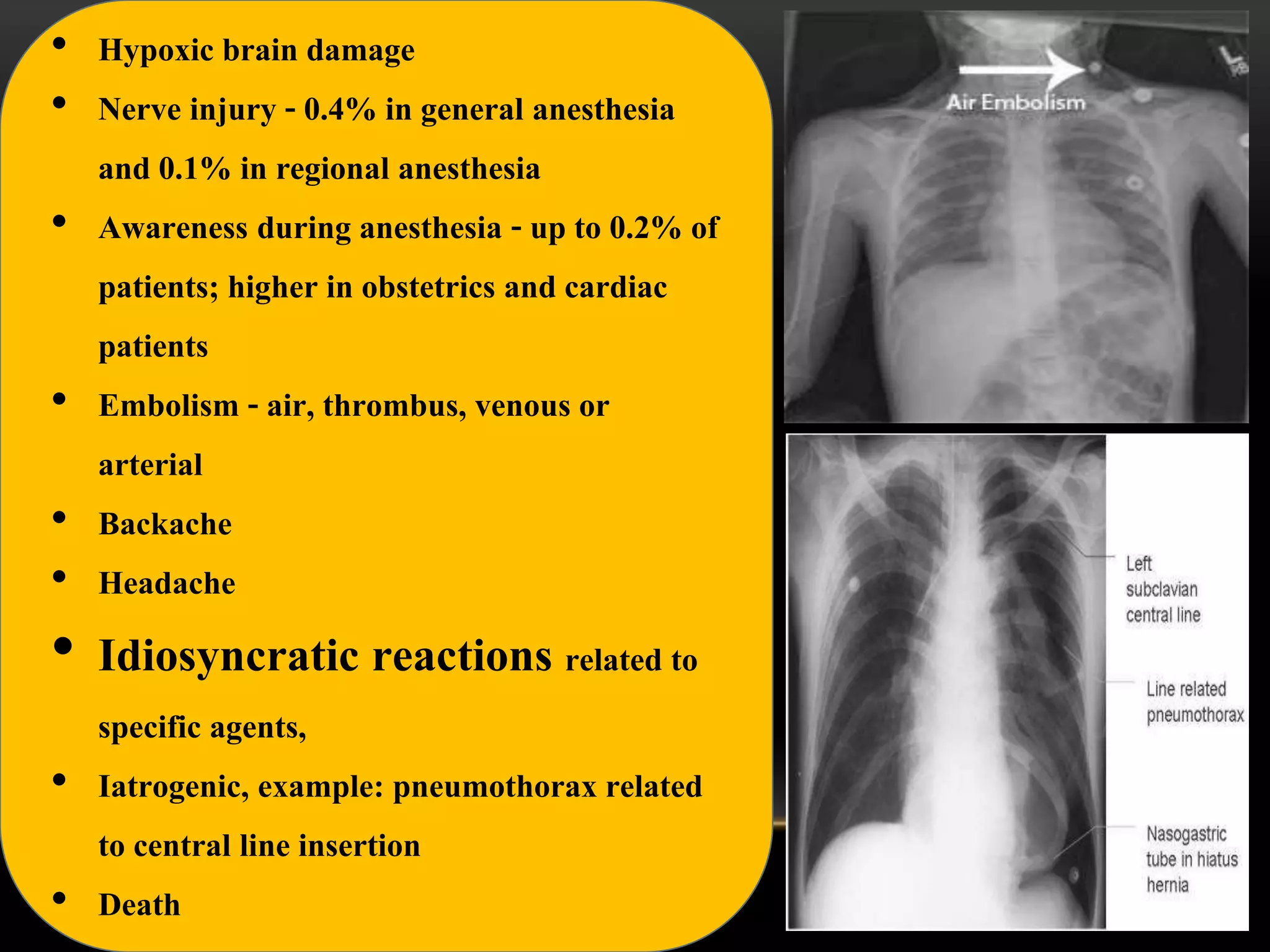 Anaesthetic death ppt | PPTX