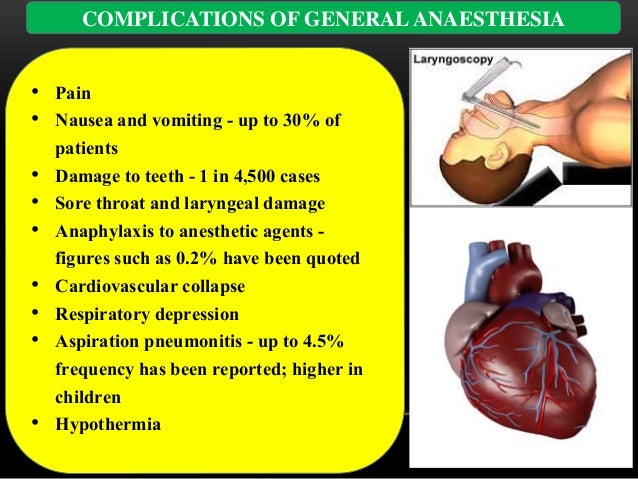 Anaesthetic death ppt