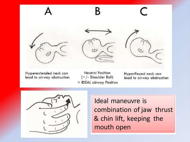 Anaesthetic implication in neonatal anaesthesia.pptx | Parenting Babies ...