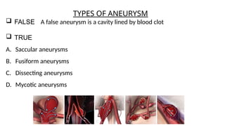 ANAESTHETIC MANAGEMENT OF INTRA CRANIAL ANEURYSM.pptx