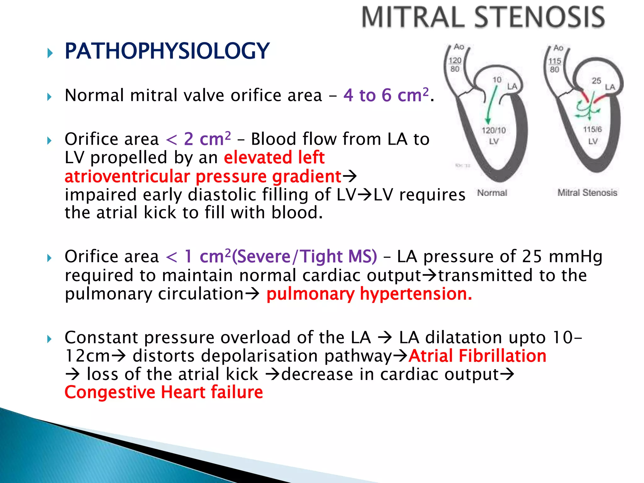 Anaesthetic management of mitral valvular heart disease | PPTX