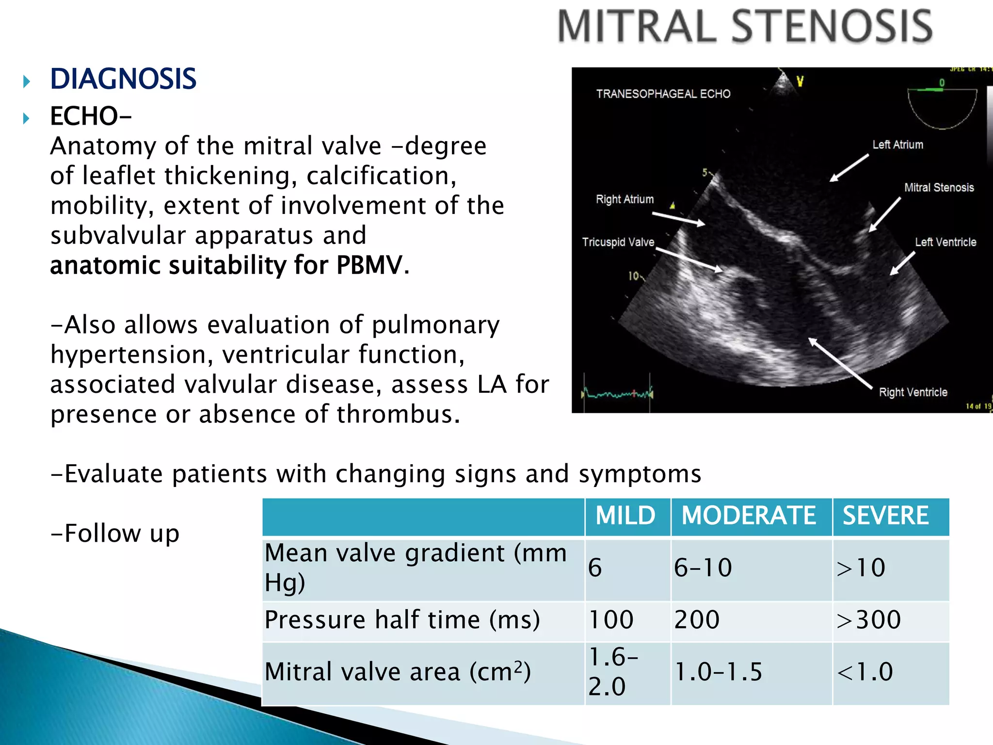 Anaesthetic management of mitral valvular heart disease | PPTX