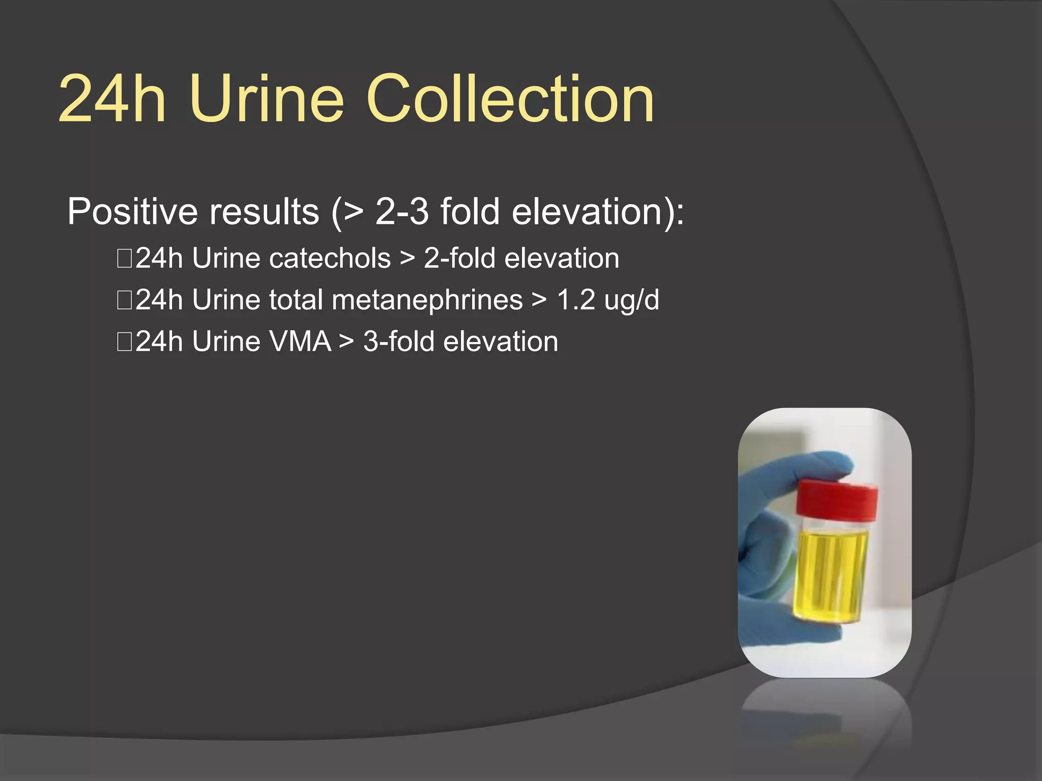 Anaesthetic management of pheochromocytoma | PPTX