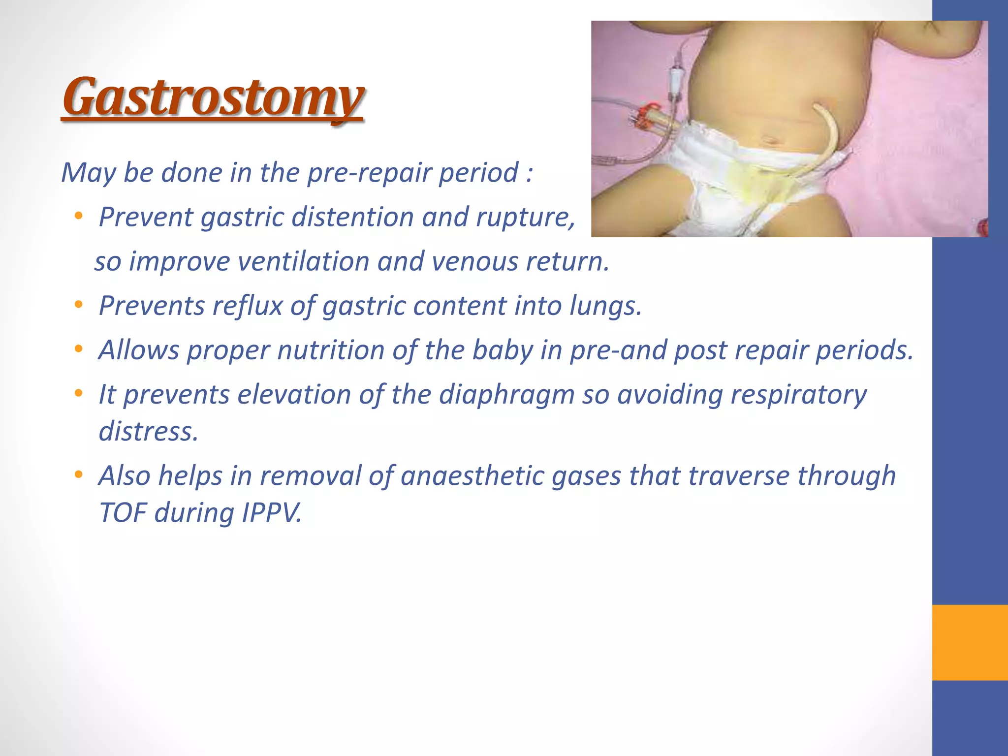 Anaesthetic management of tracheoesophageal fistula and congenital ...