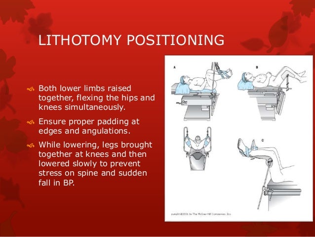 Anaesthetic managent of turp