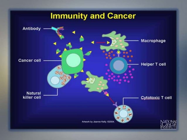 Role of Anaesthetic Techniques in Prevention of Cancer Recurrence | PPT