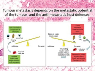 Role of Anaesthetic Techniques in Prevention of Cancer Recurrence | PPT